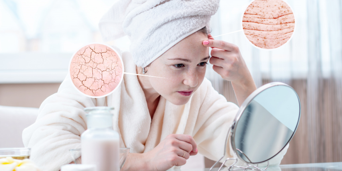 The Impact of Stress on Skin Health and Coping Mechanisms | Flourish Clinic